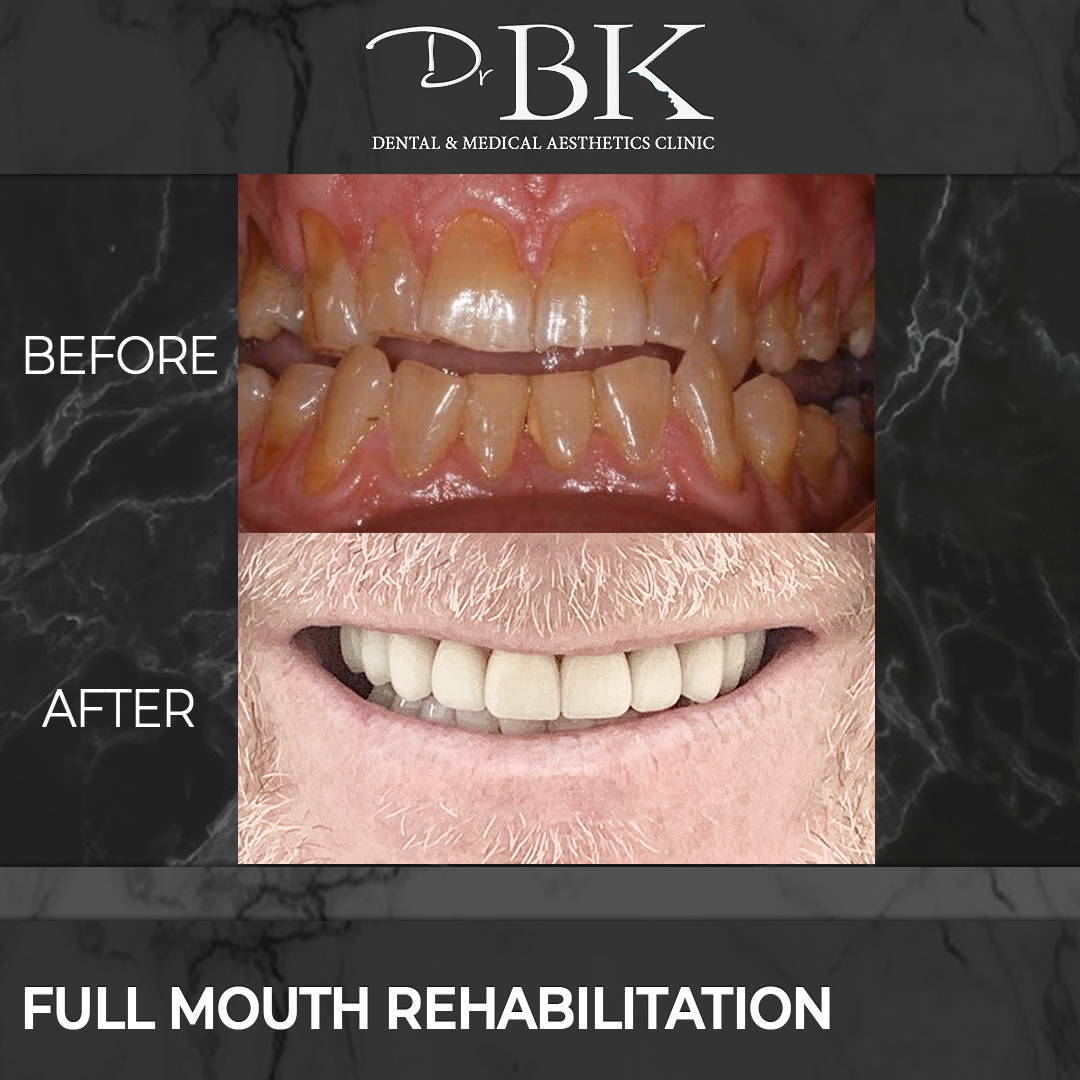 Before & After Pics of Aesthetic Treatments Available at DRBK